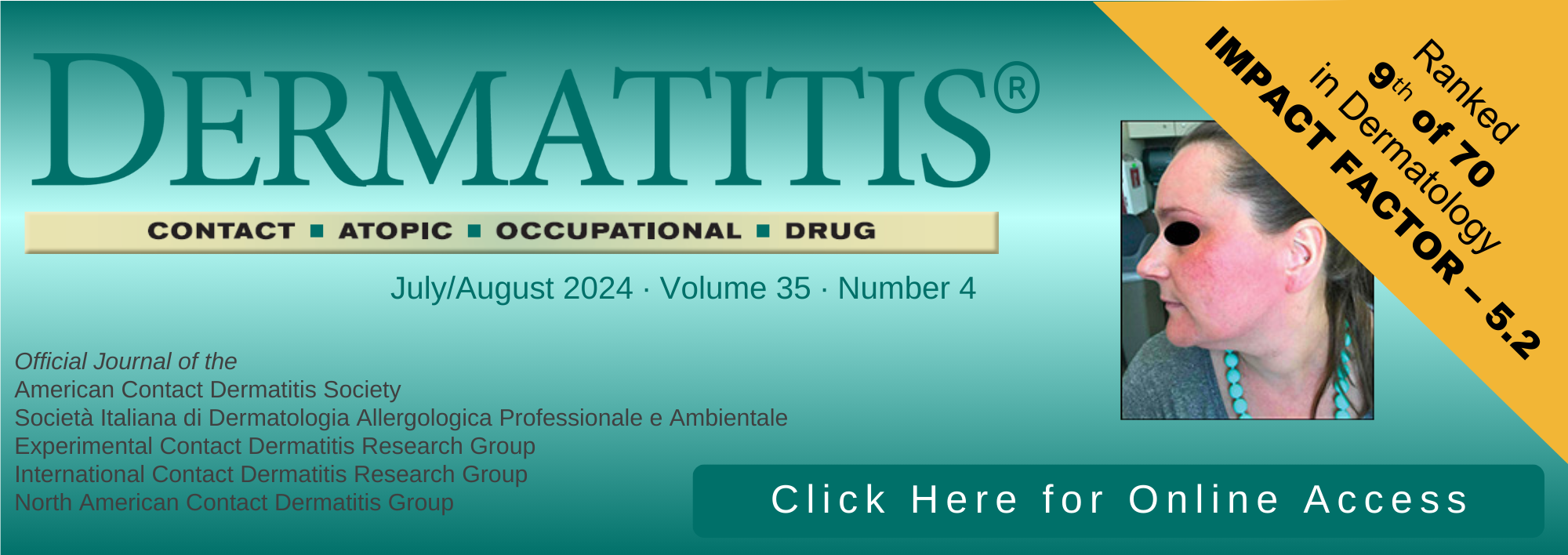 American Contact Dermatitis Society Acds
